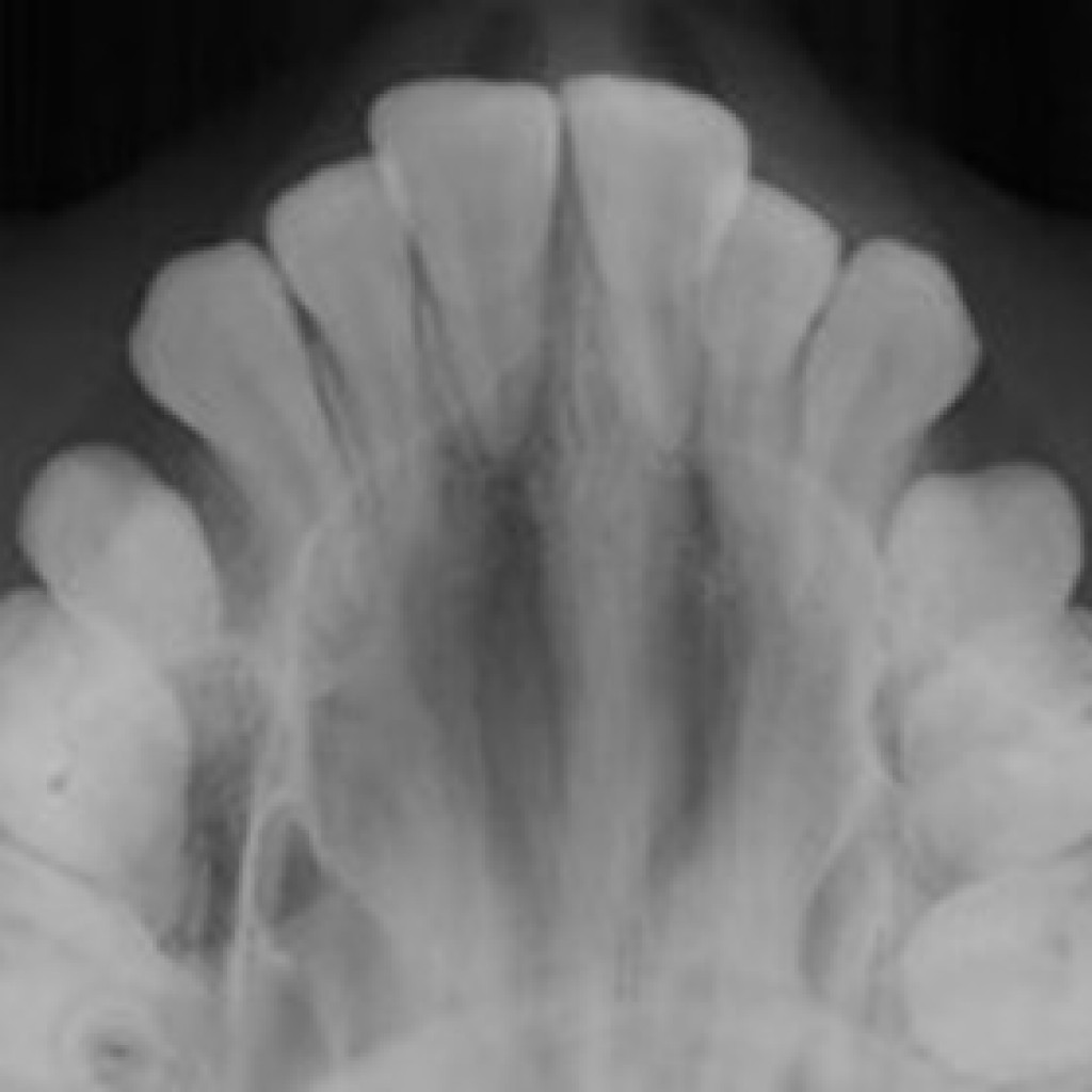 Imágenes Digitales: OCLUSAL