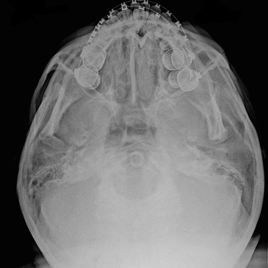 Imágenes Digitales: SUBMENTO VERTEX